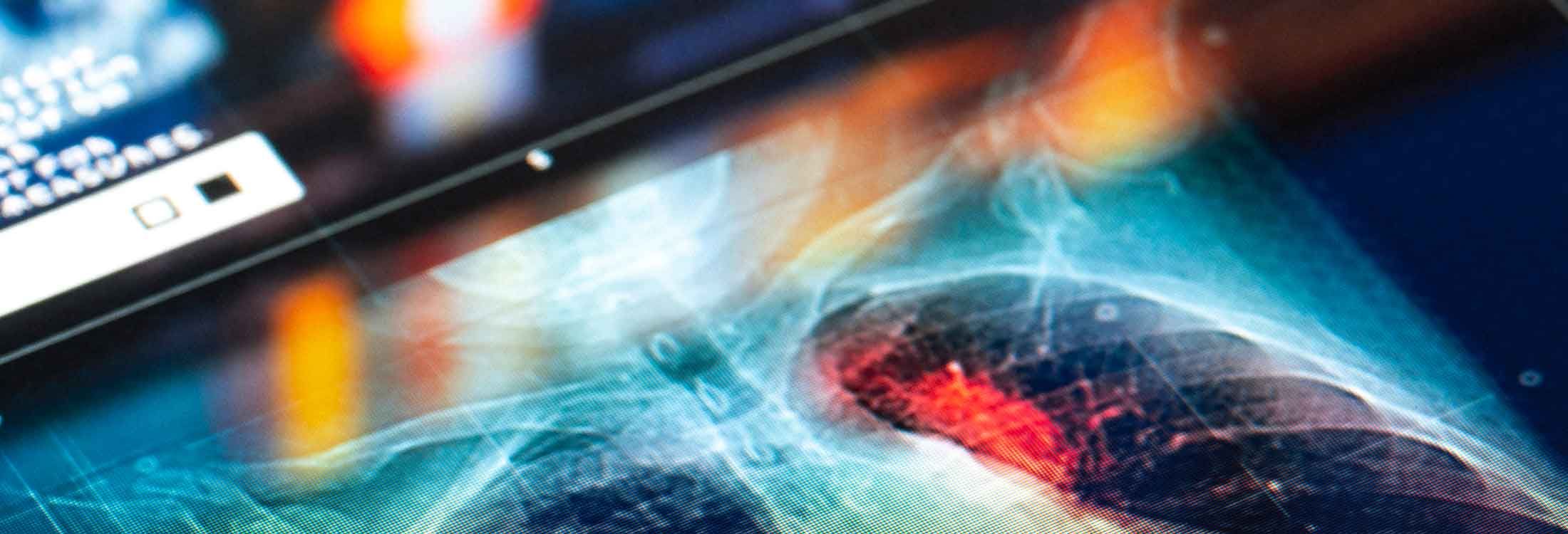 Connected, Continuous, Insight-driven Multidisciplinary Cancer Care ...